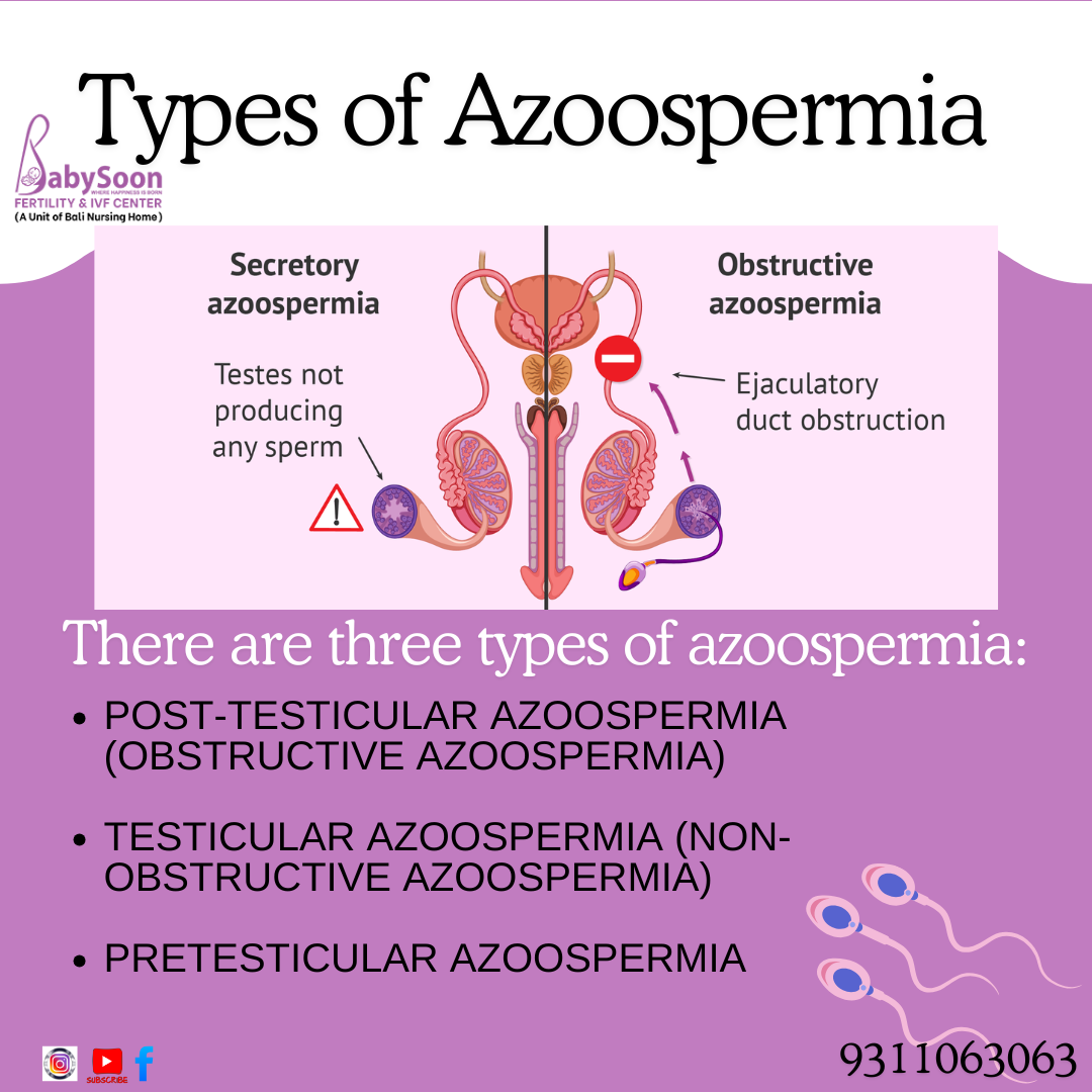 Types of Azoospermia Explained: Causes and Treatments 2025